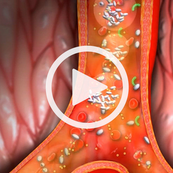 Medical Legal Exhibits - Legal Animations & Trial Graphics