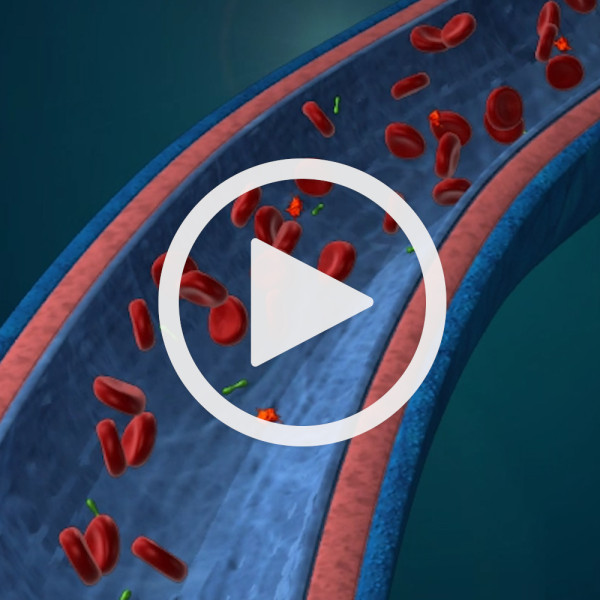 Medical Legal Exhibits - Legal Animations & Trial Graphics - Tria...