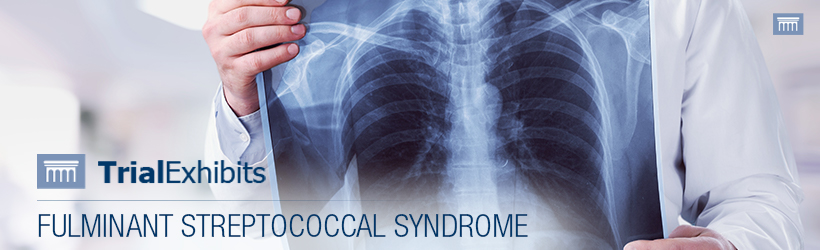 Fulminant Streptococcal Syndrome - TrialQuest Inc.