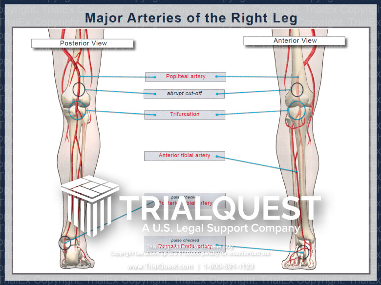 Major Arteries Of The Right Leg Trial Exhibits Inc 